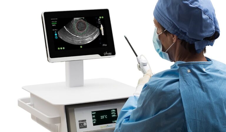 Introducing the Sonata® Treatment, A Breakthrough Fibroid Procedure